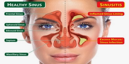 Pesona Mama Manja: Apa Itu Resdung