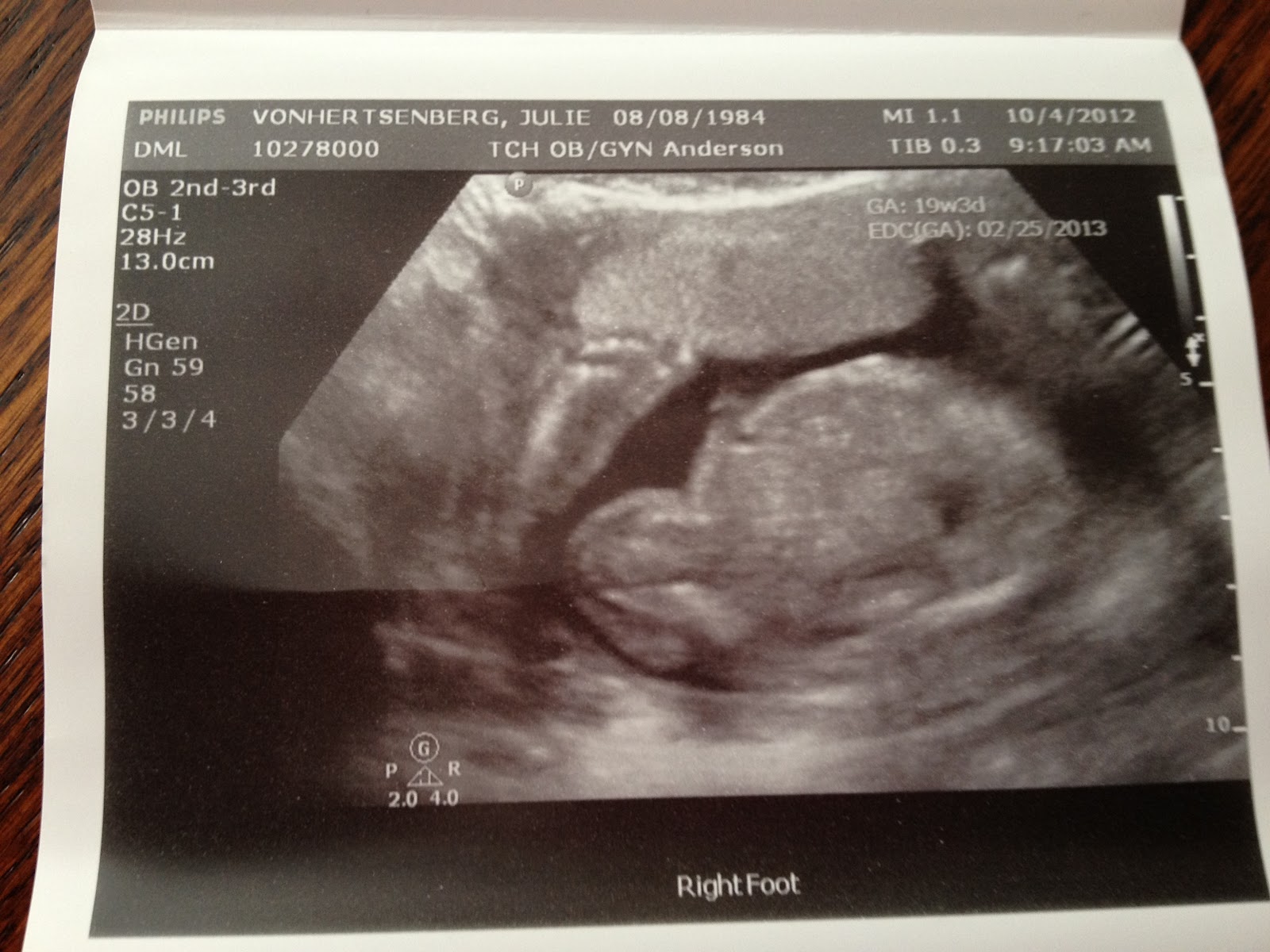 Our Family Journey: It's a Girl!! Ultrasound Pictures 19 weeks 3 days