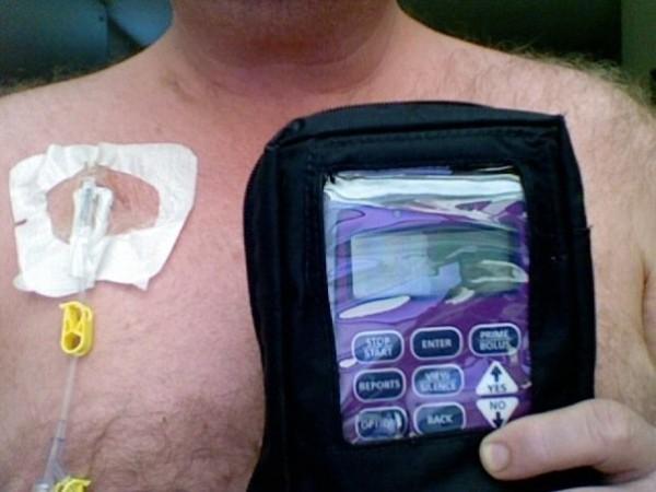 Kanserle Dans: Kemoterapi A-B-C'si Bölüm II