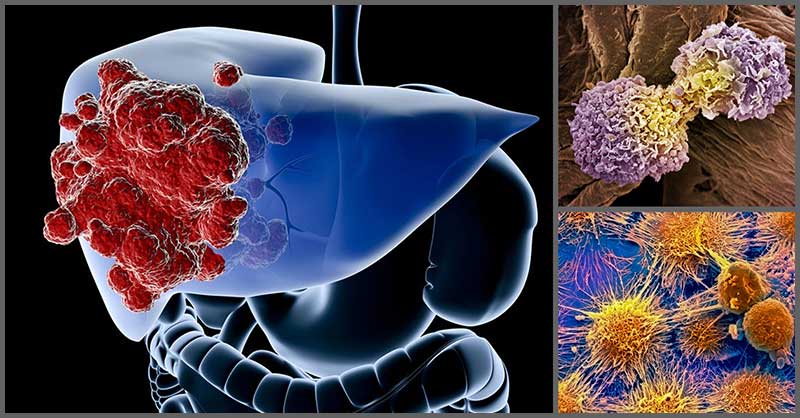 Main Reasons Why Cancer Cells Mutate And Multiply | Dr Farrah MD