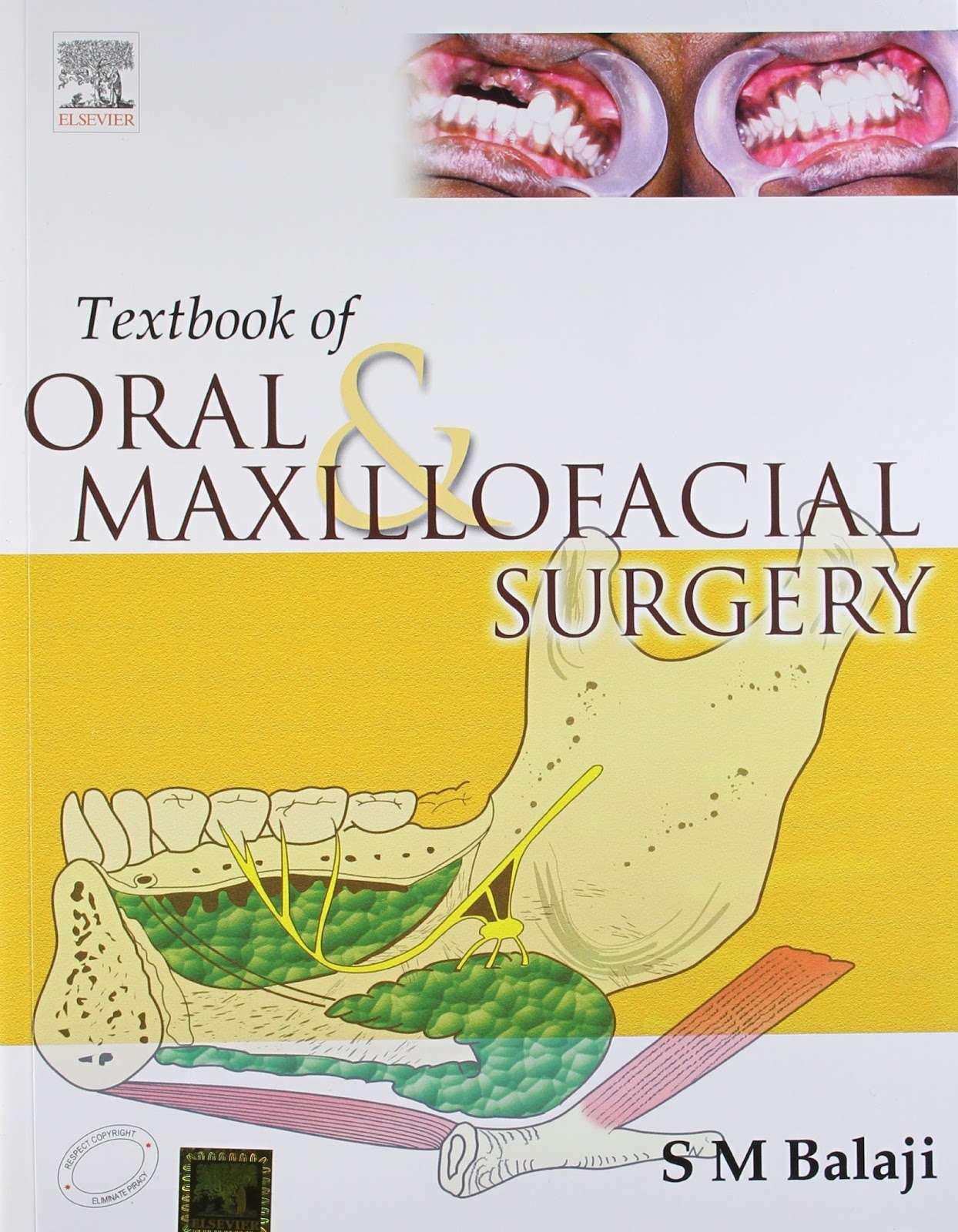 Dental Ebooks: Textbook of Oral and Maxillofacial Surgery