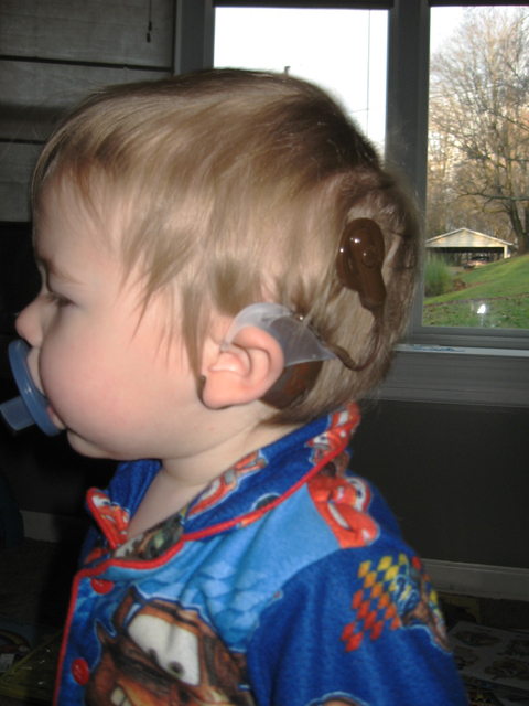 Redefining "Normal": My Cochlear Kid