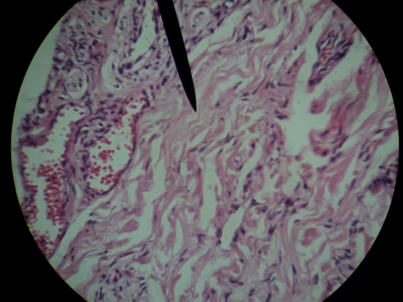 MEDICINA USMP: FOTOS DE HISTO