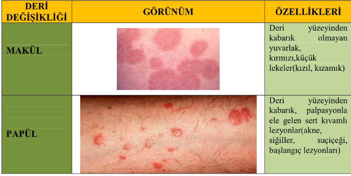 3.2. Deride Görülen Değişiklikleri
