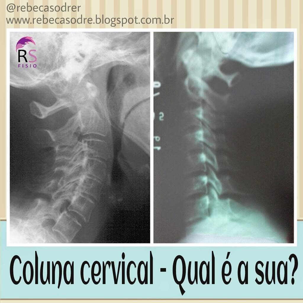 Rebeca Sodré Fisioterapeuta: Como vai a sua coluna cervical?