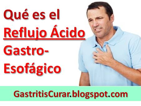 Qué es el Reflujo Ácido Gastroesofagico: Causas, Síntomas y Tratamiento ...