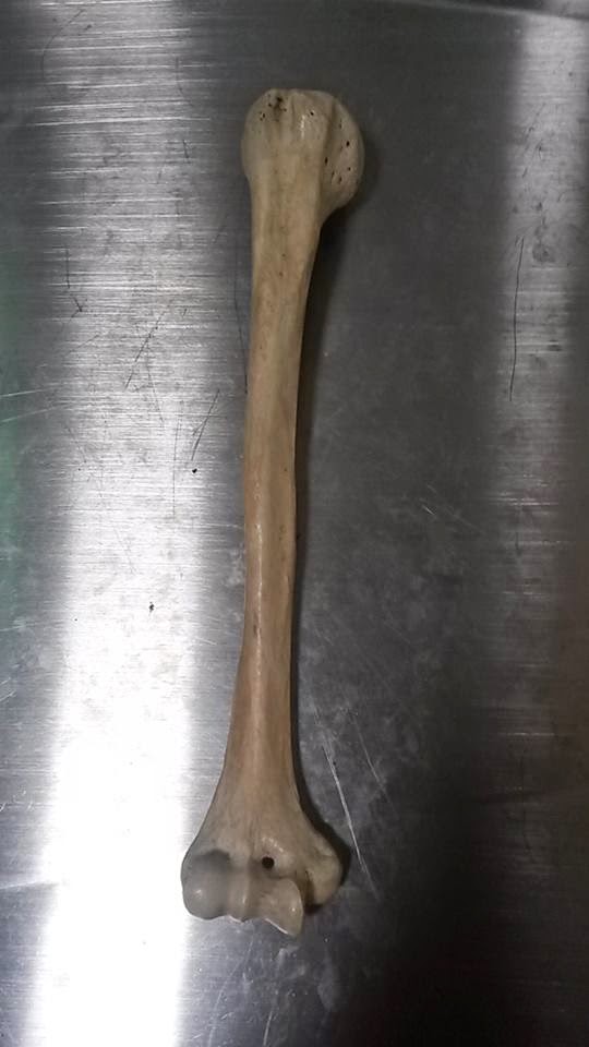 Morfofisiologia : Miembro Superior