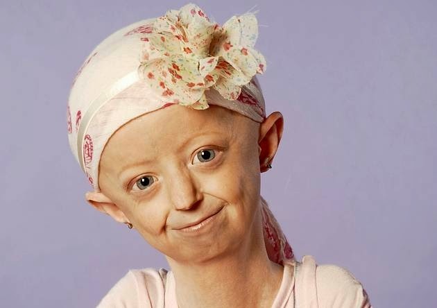 ETL NEWS BLOG: ''100-year-old teenager'' and Progeria campaigner ...