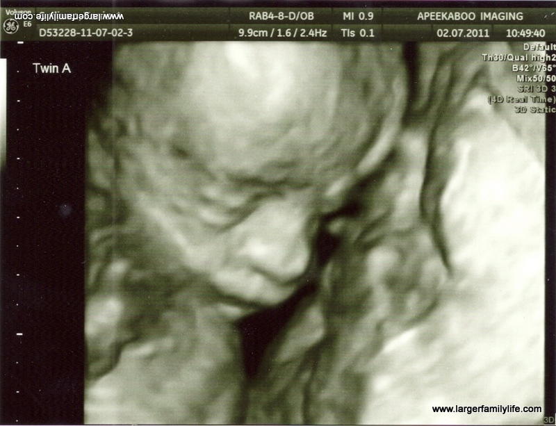 4d baby scans, anomaly scans and the miracle of life | Larger Family Life