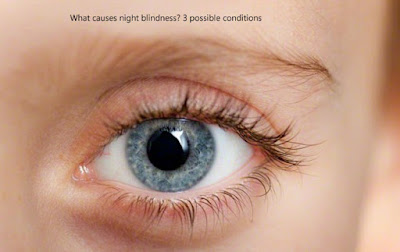 Heath Care: What causes night blindness? 3 possible conditions