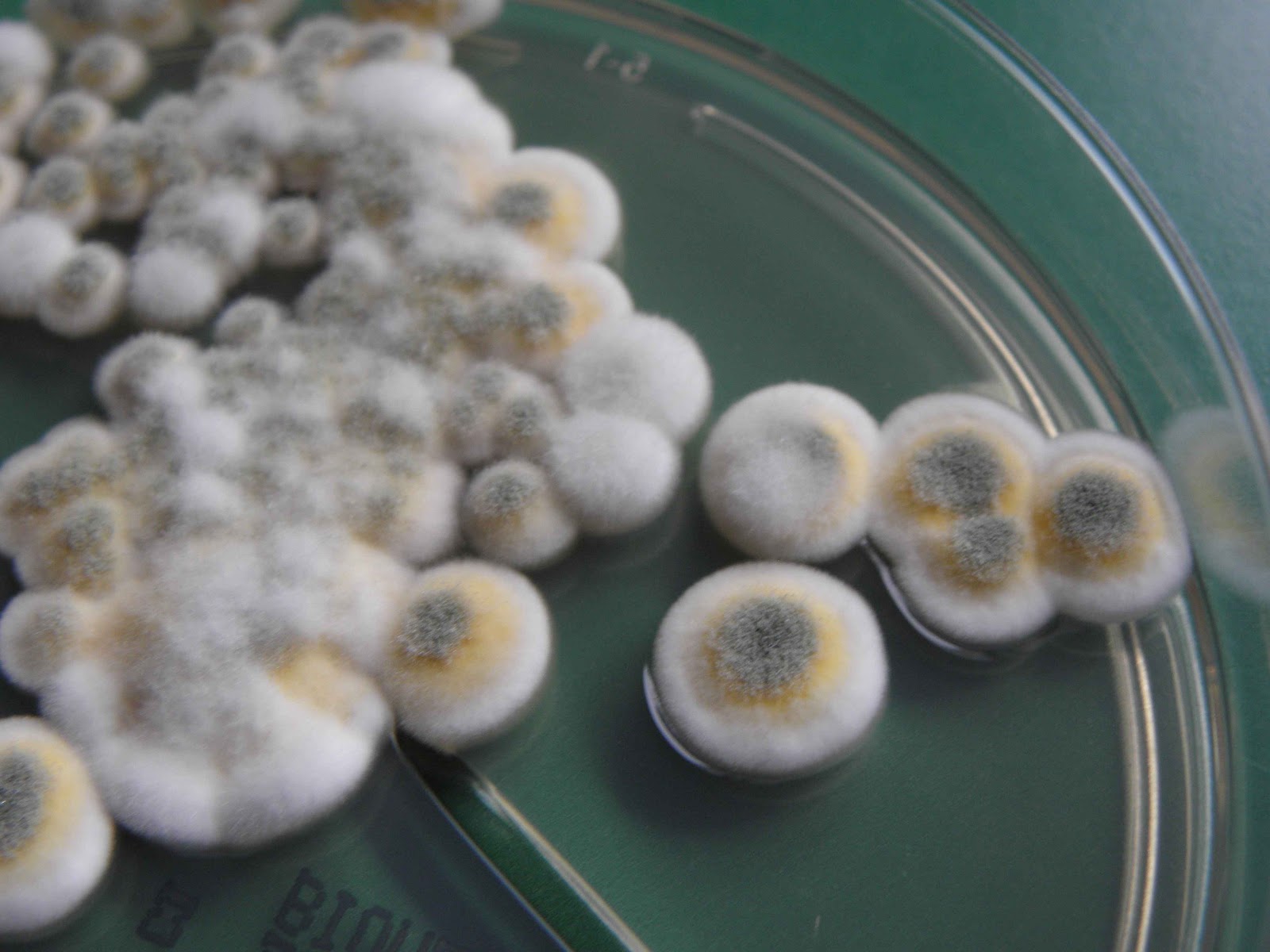 ATLAS MICOLOGIA: ASPERGILLUS VERSICOLOR