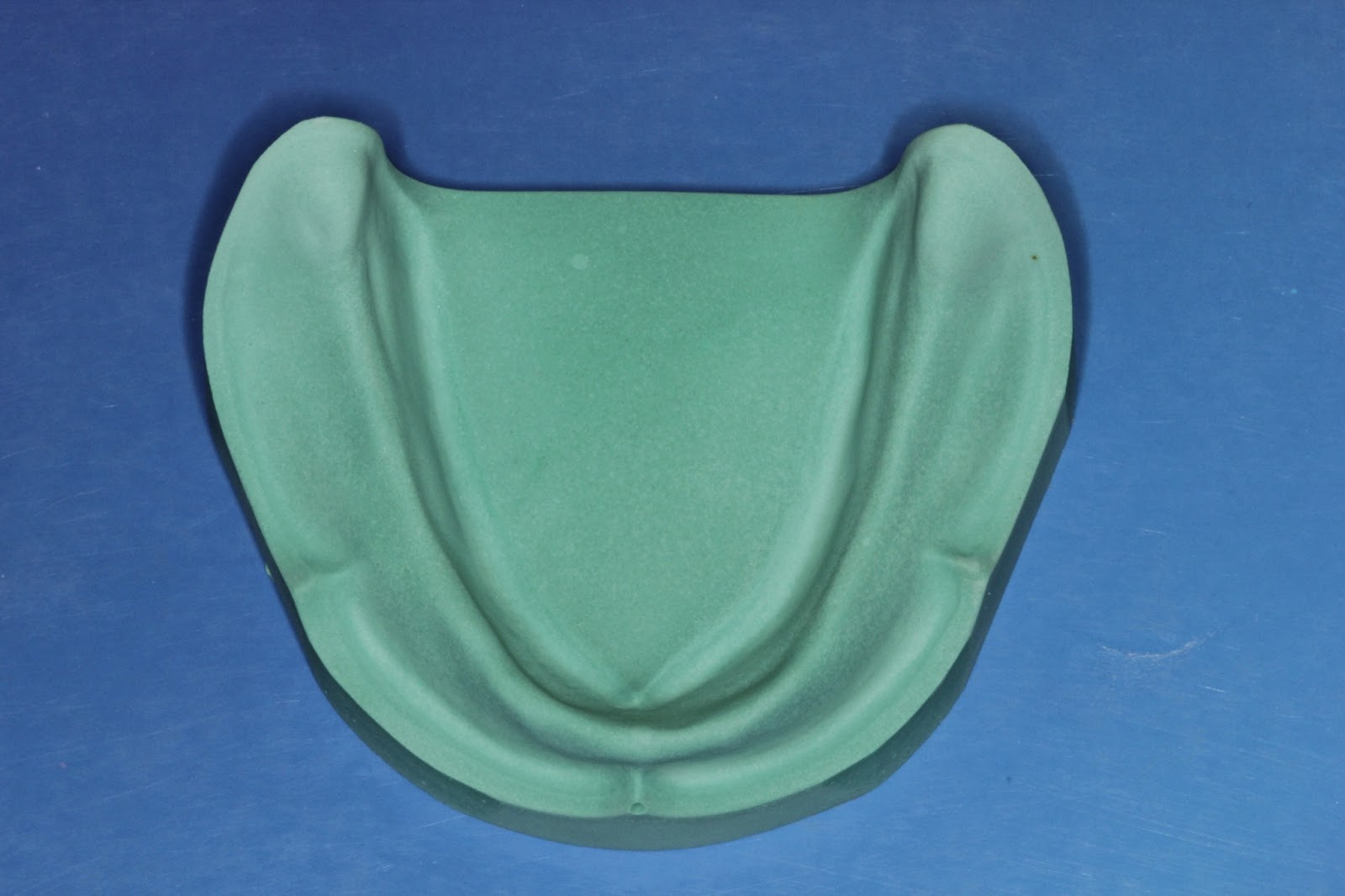 Understanding Prosthodontics - Tagore Dental College & Hospital-By ...