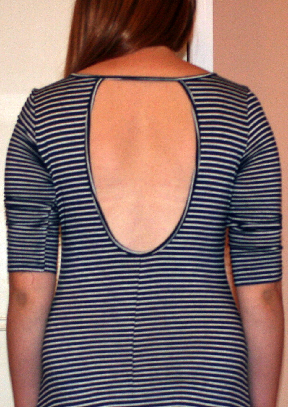 Flowertopsfi: Opinions on Low Back Dresses