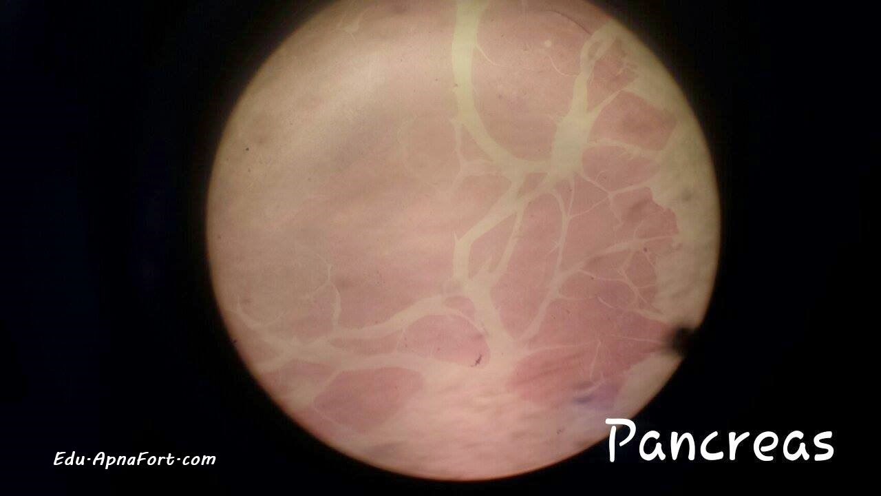 Educational Blog : Pancreas slides