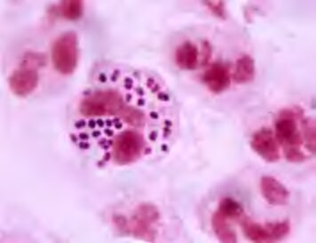 Materia Medica Homeopatica: MEDORRHINUM (Gonococcinum; Nosode de la ...