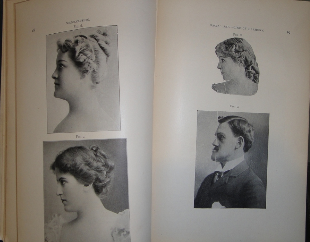 ORTODONTIA CONTEMPORÂNEA: Livro clássico com 112 anos, do Professor ...