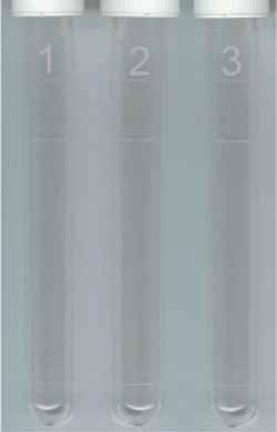 [Haematology] Cerebrospinal Fluid Analysis - Specimen Collection | Free ...