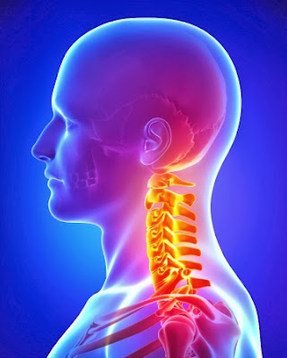 Clínica Luis Baños: LATIGAZO CERVICAL