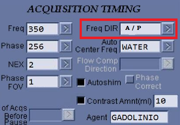 El Baúl Radiológico: ARTEFACTOS EN EL SENTIDO DE LA CODIFICACIÓN POR LA ...