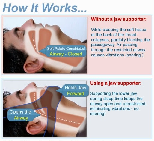 Under The Angsana Tree: How To Stop Snoring And Sleep Well Again