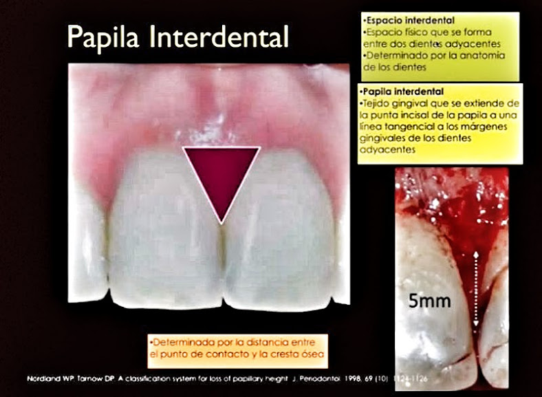 ENTREVISTA: Regeneración de la Papila Gingival con Ácido Hialurónico ...
