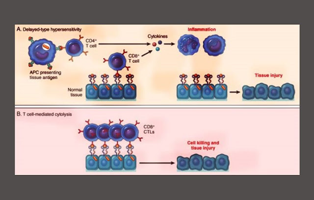 Alergi : Pengertian, Penyebab, Reaksi, Tipe, Tanda - Jegeristik