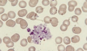 The Blood Film and Count (Part 2) | Tuyenlab