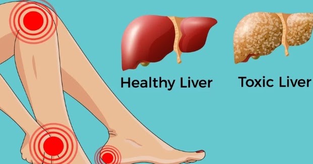 16 signs your liver is overloaded with toxins - Health Recipes Article