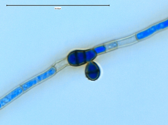 Fun With Microbiology (What's Buggin' You?): Pithomyces species