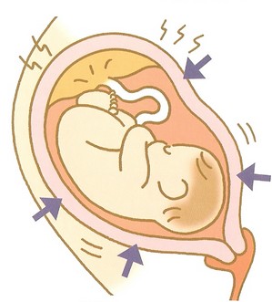 KLASIFIKASI ATAU JENIS PERSALINAN