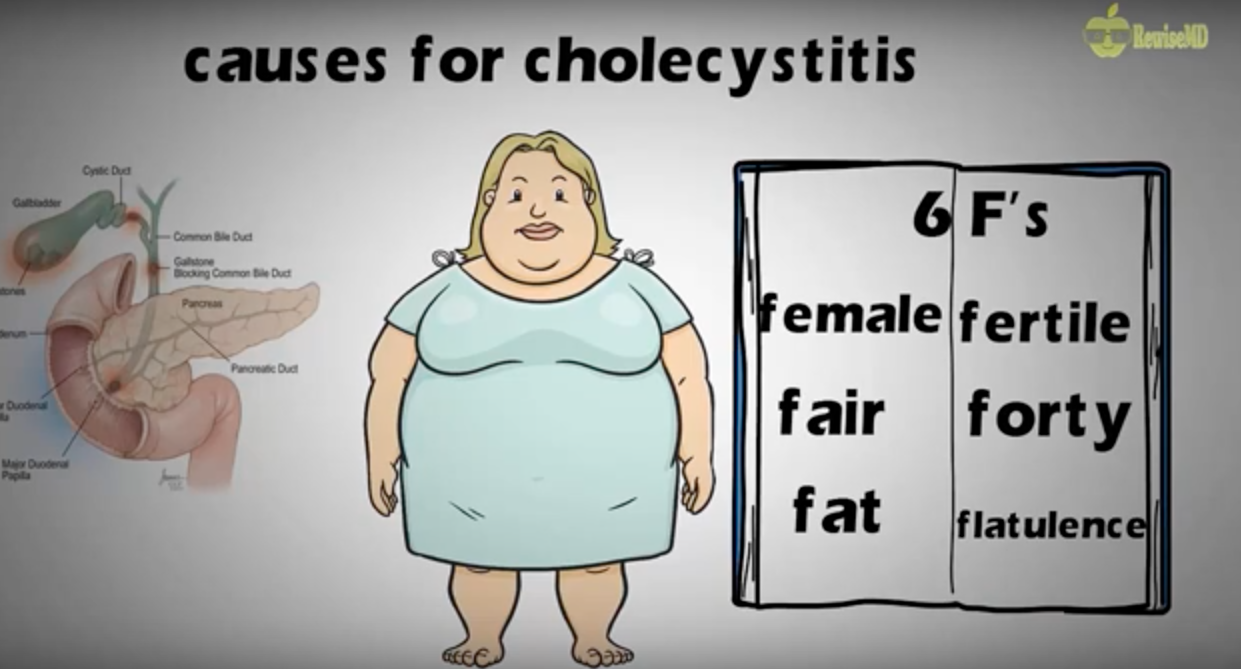 krok 2 (Gasteroenterology) with explanation part 7