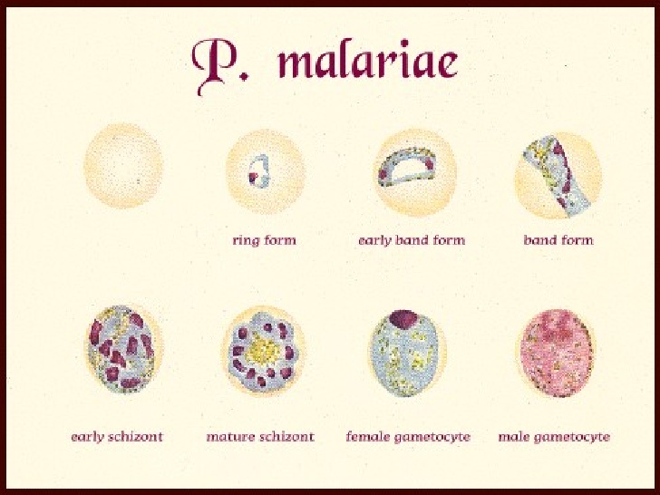 Lecture Notes in Medical Technology: Lecture # 16: CLASS SPOROZOA