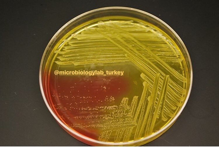 STAPHYLOCOCCUS SPP. (TÜRKÇE) - Microbiology Laboratory Turkey