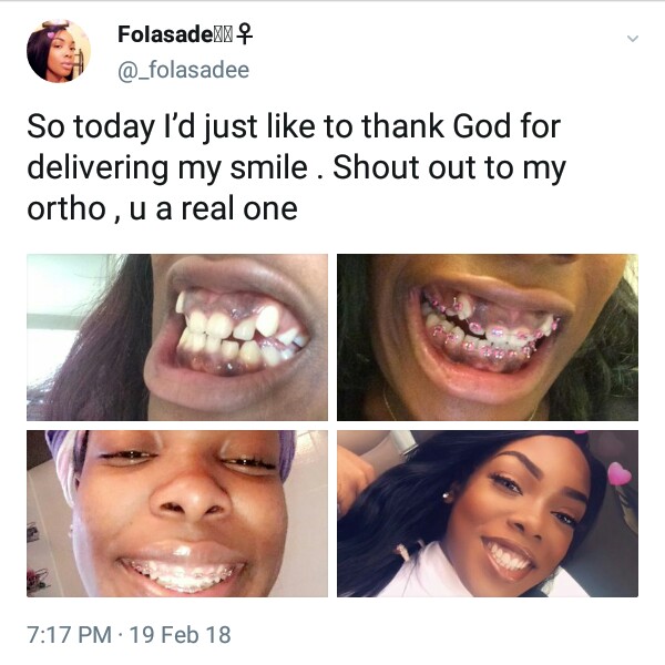 Photos: US-based Nigerian lady with deformed teeth shows off the ...