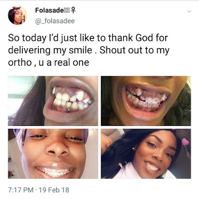 Photos: US-based Nigerian lady with deformed teeth shows off the ...