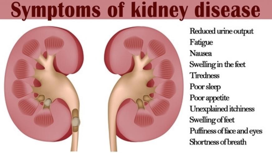 Hypercalcemia, Kidney Problems & their Cures - Your Learning Point
