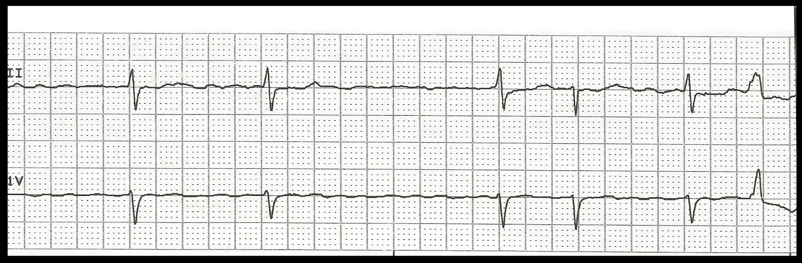 Basic EKG Rhythm Test 08