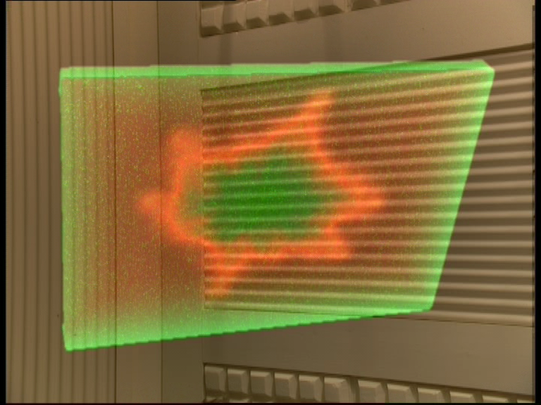 Opinions Can Be Wrong: Red Dwarf VII Episode 7: "Epideme"