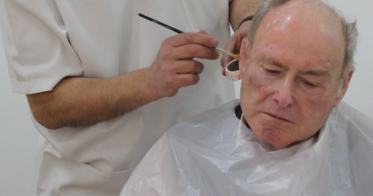 Anaplastologia: Prótesis auricular