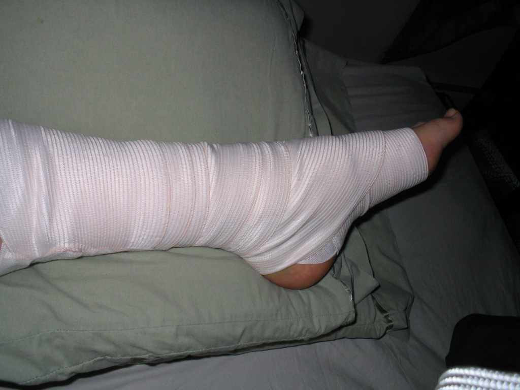 1wuz's chalk board.: Gimp Foot