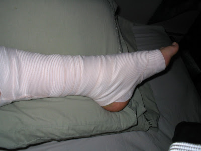 1wuz's chalk board.: Gimp Foot