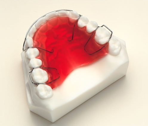 O retentor Hawley - DJ Laboratório