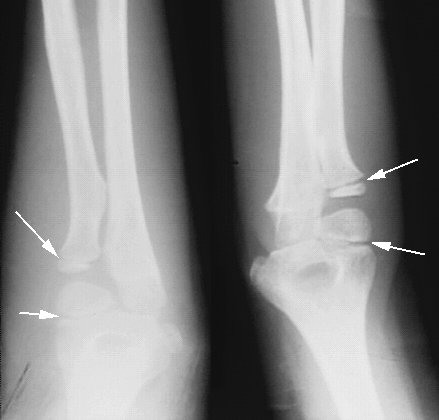 Radiation Protection