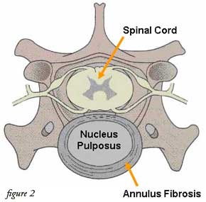 Michigan Veterinary Blog: Intervertebral Disc Disease and Herniated ...