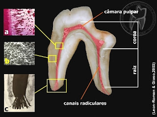 Apicetomia - CIRURGIA BUCOMAXILOFACIAL