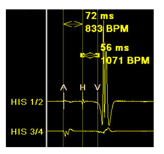 Zobrazovací metody #5 - Základy elektrofyziologie 1/2 - Kardioblog