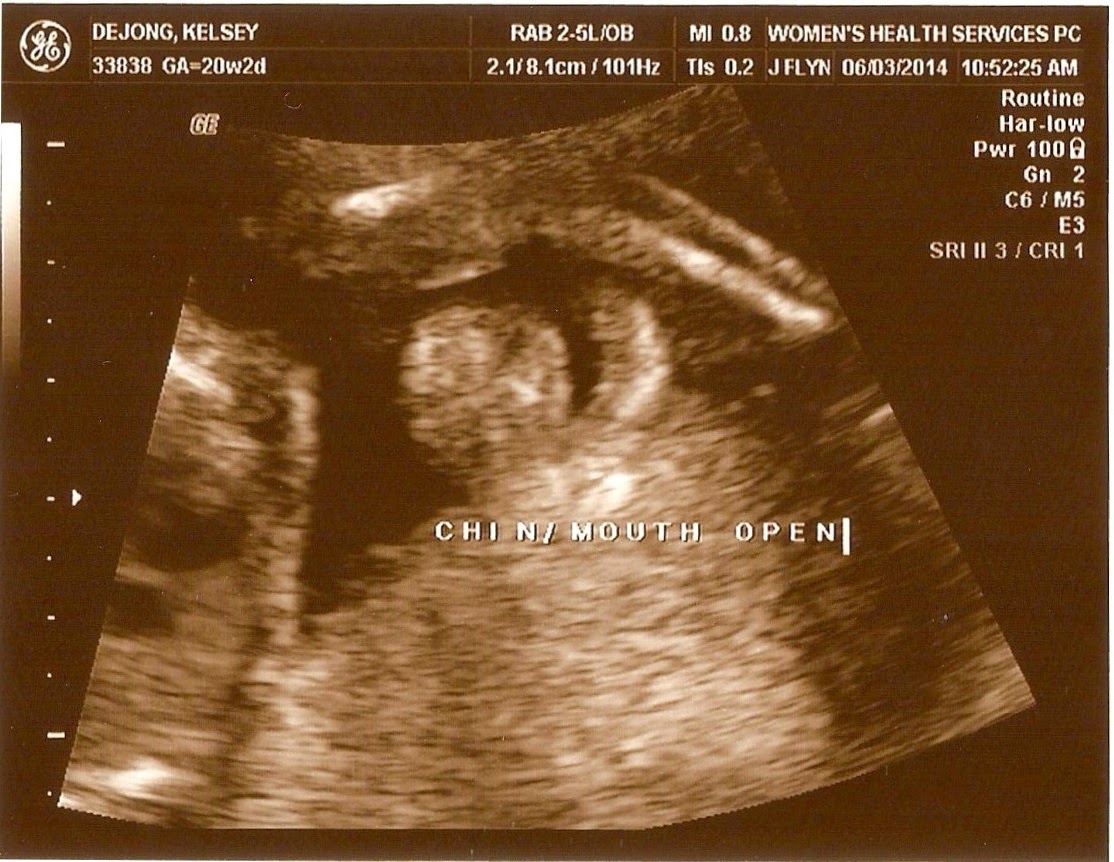 20 week ultrasound. ~ A Day with the De Jongs