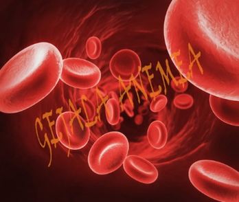 10 Ciri Gejala Penyakit Anemia