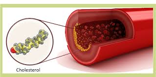 Aukštas kraujospūdis? Gydykite kaklą.
