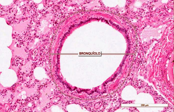 Histologia Sistema Respitaorio: Arbol Bronquial